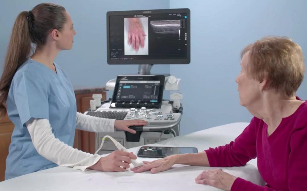 GE医疗旗舰款全身超声LOGIQ E20中国上市